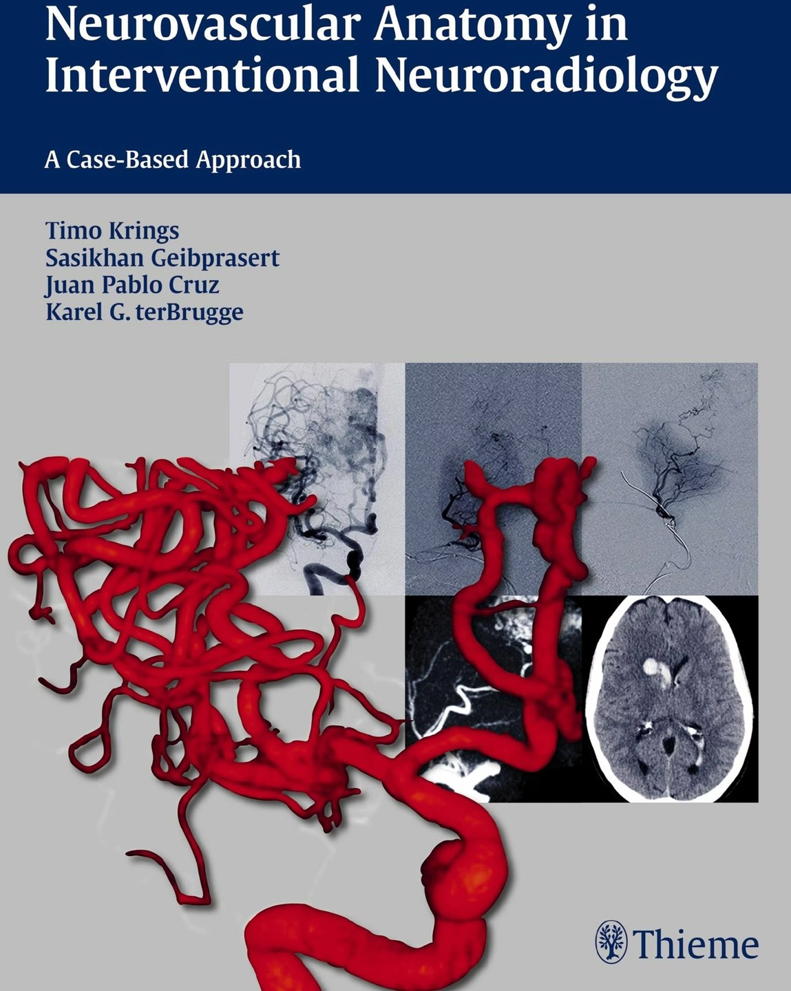 Neurovascular Anatomy in Interventional Neuroradiology (Englisch, Juan ...